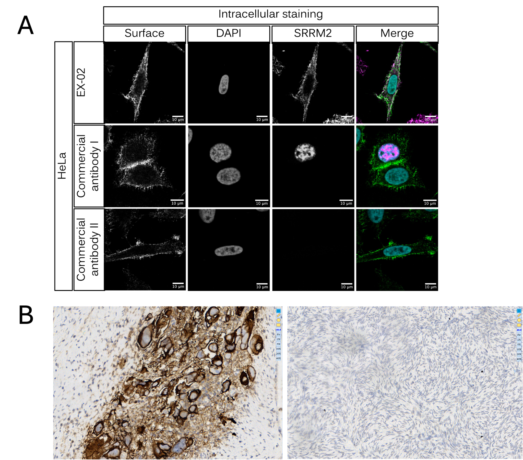 Science & Pipeline | EV-Based Cancer Antibodies